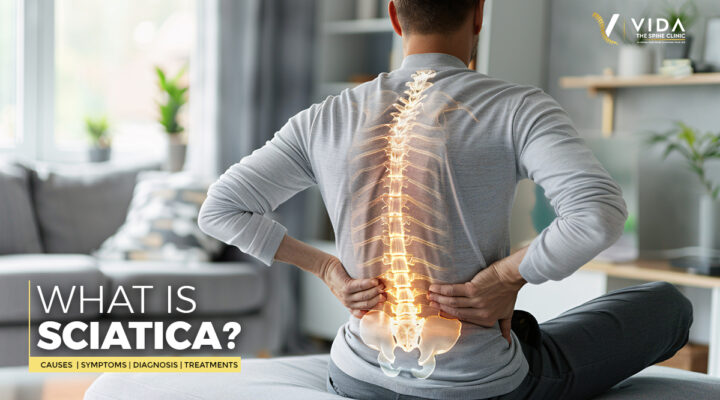 What is Sciatica? Causes | Symptoms | Diagnosis | Treatments